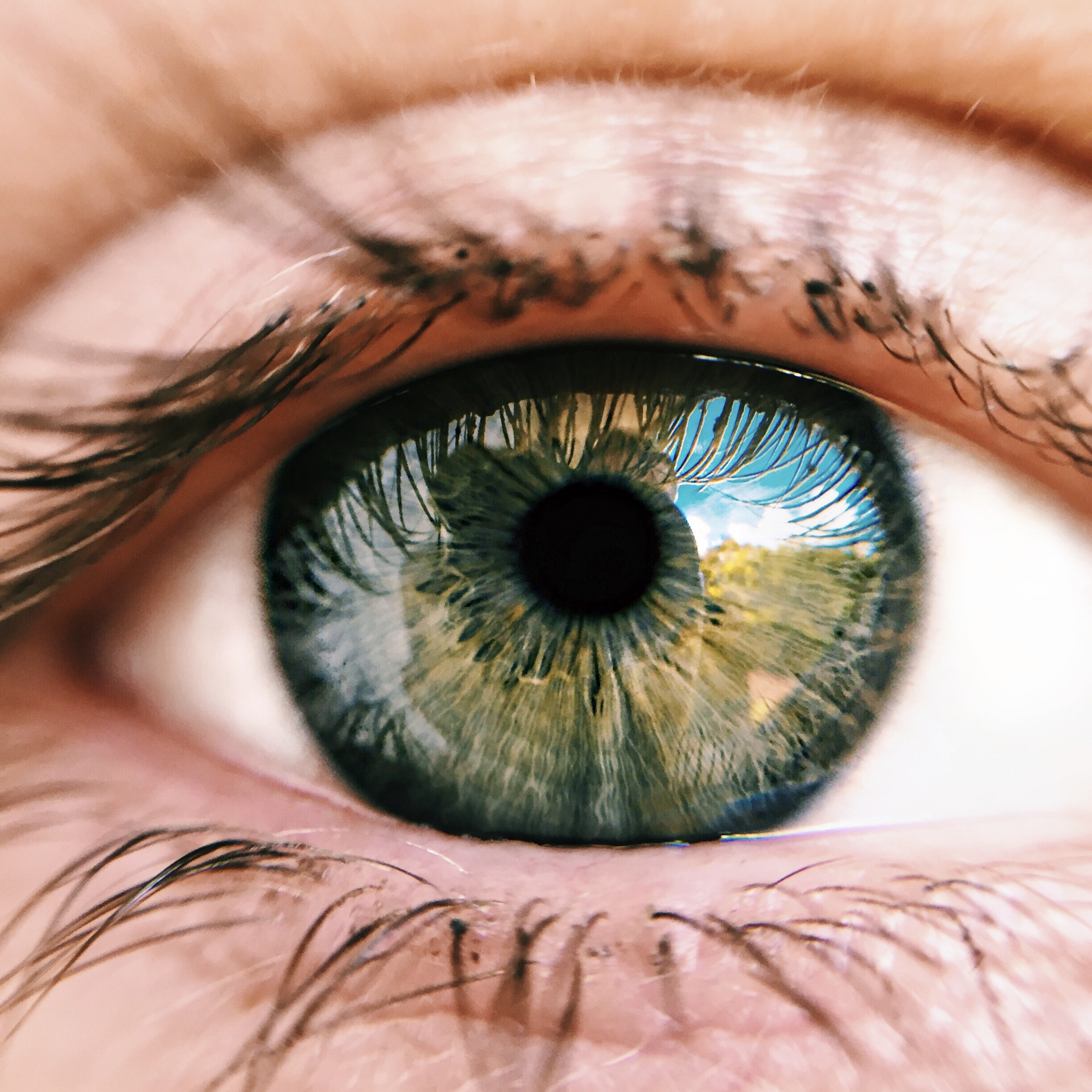 Visual Acuity Explained Activu Corporation Visual Acuity Explained Activu Corporation